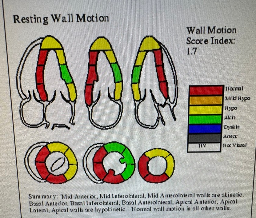The Hyper Excited EKG – GlobeMedic
